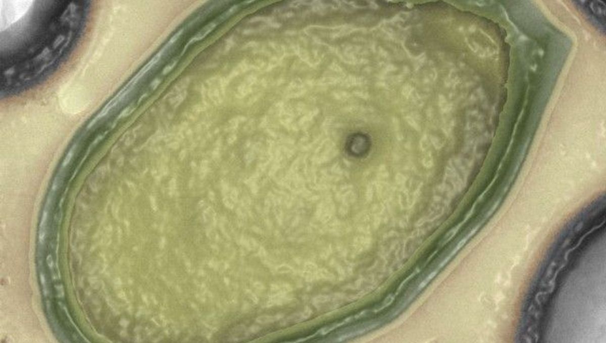 Pandoraviruses: the giants of the virus world | IFLScience