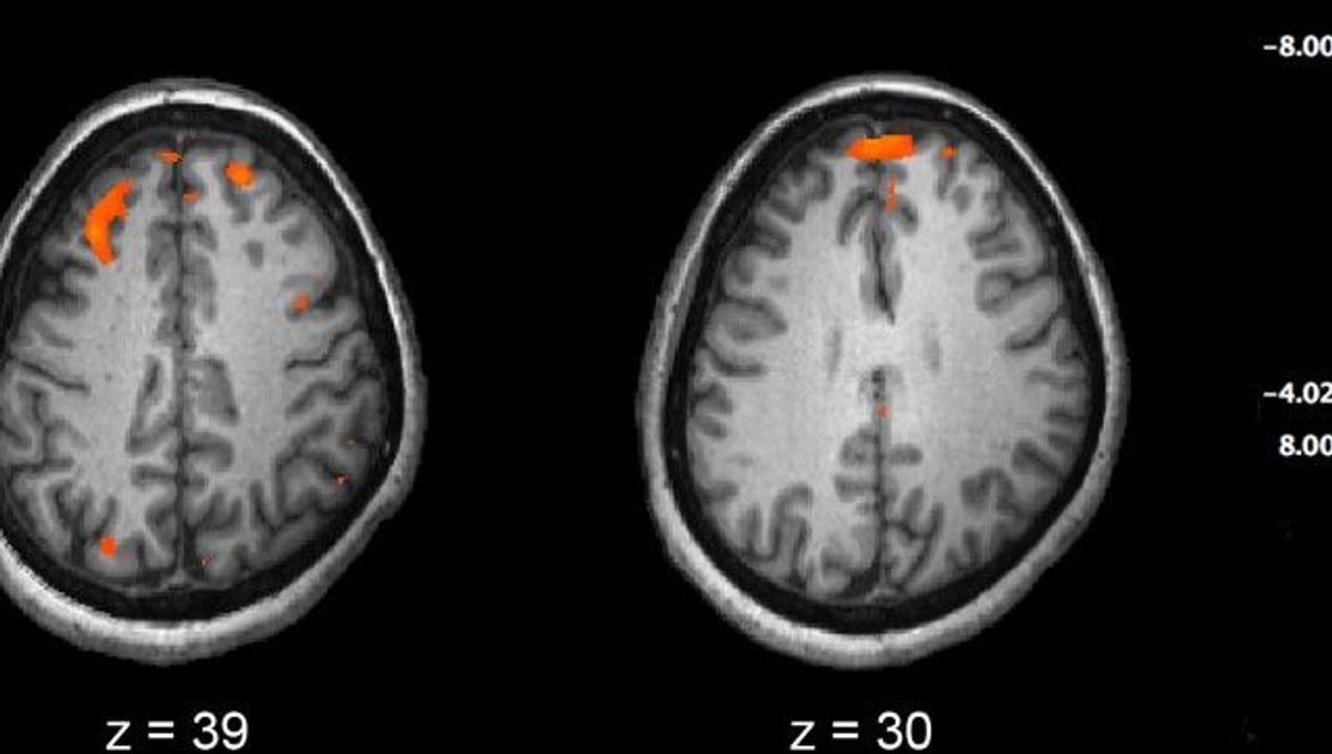 Bionic Implant to Treat Mental Disorders in Development | IFLScience