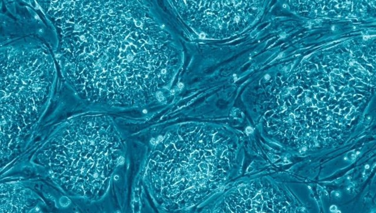Stem cell breakthrough could be a game changer for personalized ...