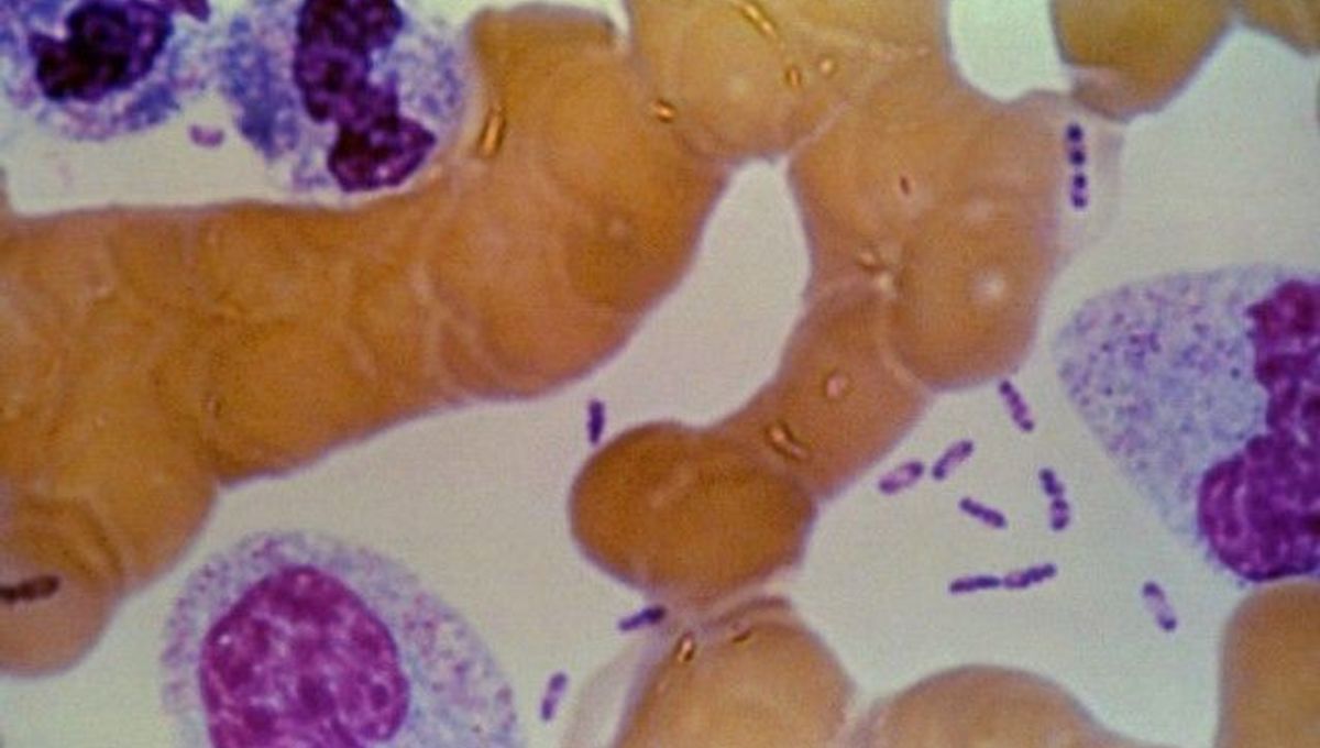 The Black Death Reshaped the Human Genome | IFLScience