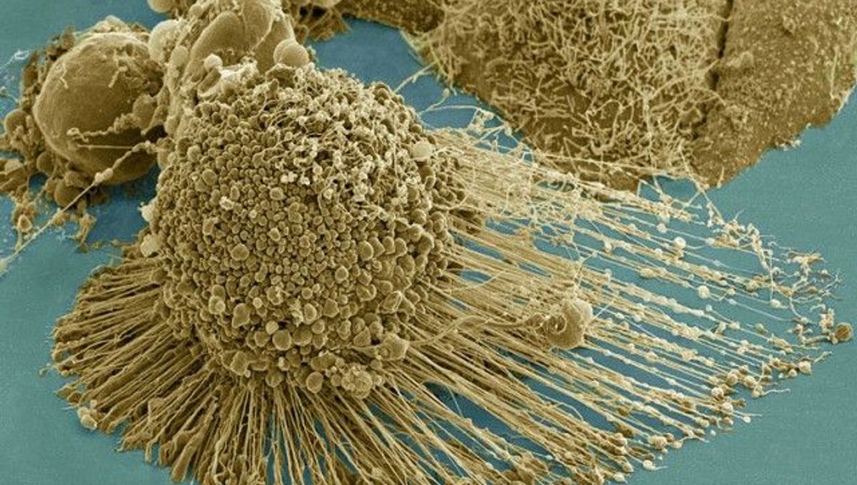 New Cancer Treatment Causes Cells To Explode | IFLScience