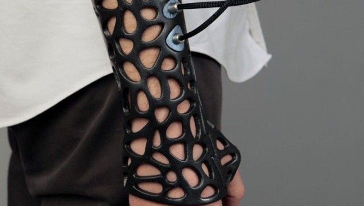 3D Printed Cast Speeds Bone Recovery Using Ultrasound | IFLScience