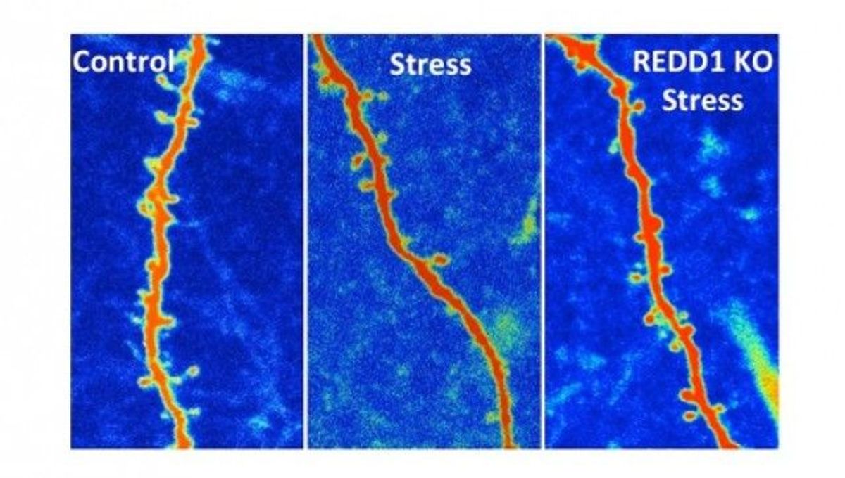 Study Reveals New Approach For Blocking Neuronal Damage From Stress ...