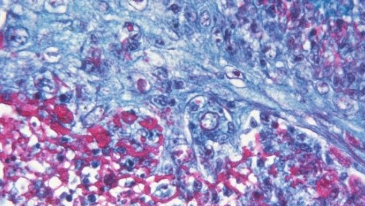 Smallpox Vials Found In Unapproved Laboratory | IFLScience