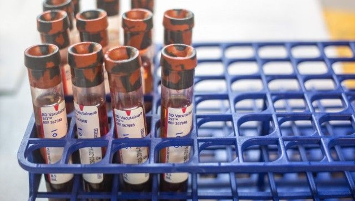 Your Blood Type Could Affect Your Memory | IFLScience