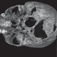 Richard 3rd Skull