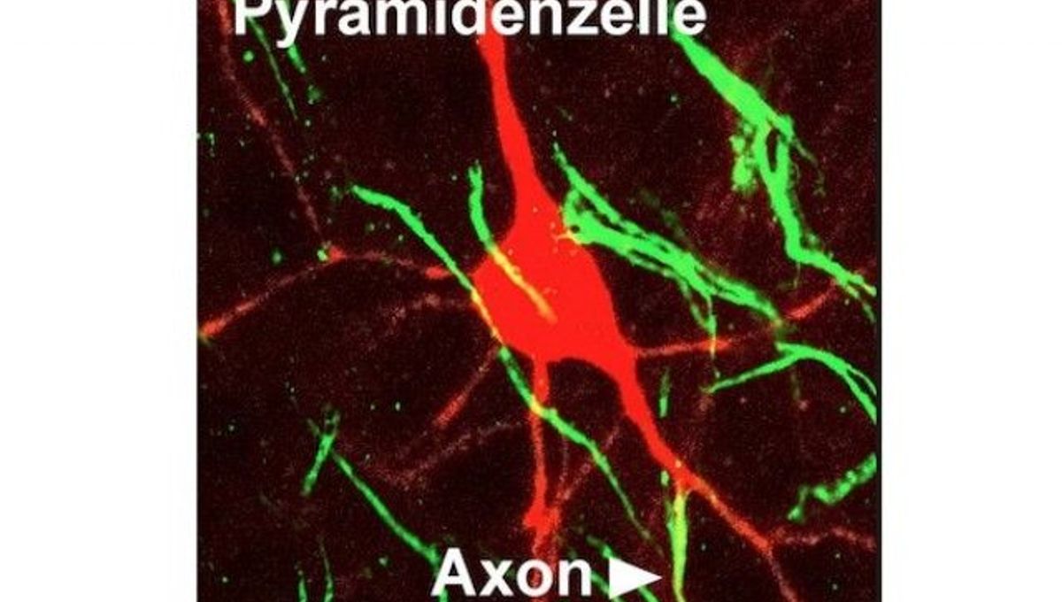 Scientists Discover Strange New Brain Cell Shape | IFLScience