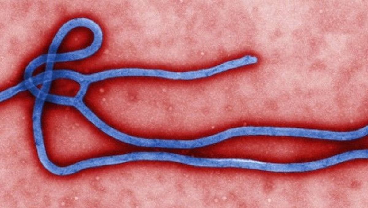 First Ebola Case Diagnosed in the U.S. Confirmed | IFLScience