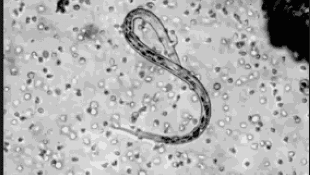Watch White Blood Cells Attack A Nematode Larva | IFLScience