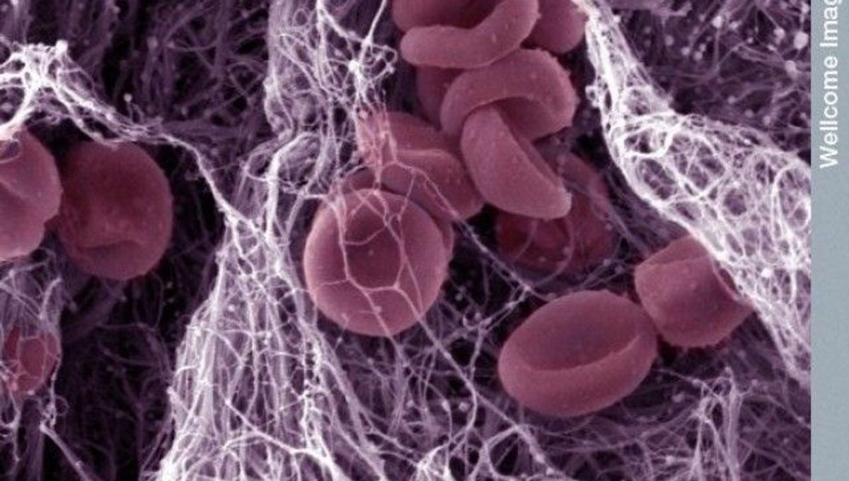 New Synthetic Platelets Capable Of Rapidly Stopping Bleeding | IFLScience