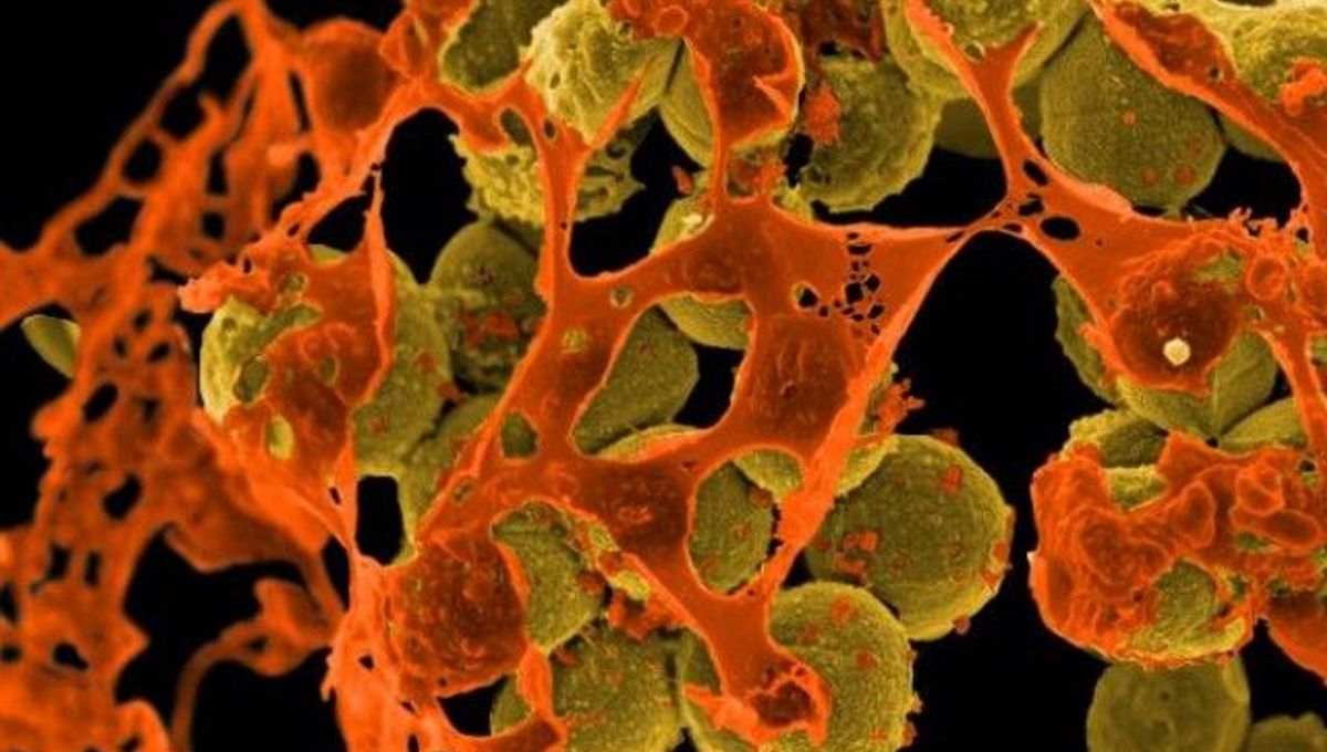 Superbugs Could Kill 10 Million Each Year By 2050, Overtaking Cancer ...