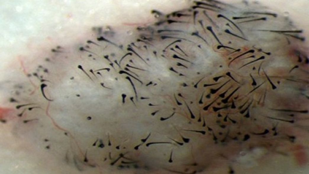 Scientists Grow Hair Using Stem Cells | IFLScience