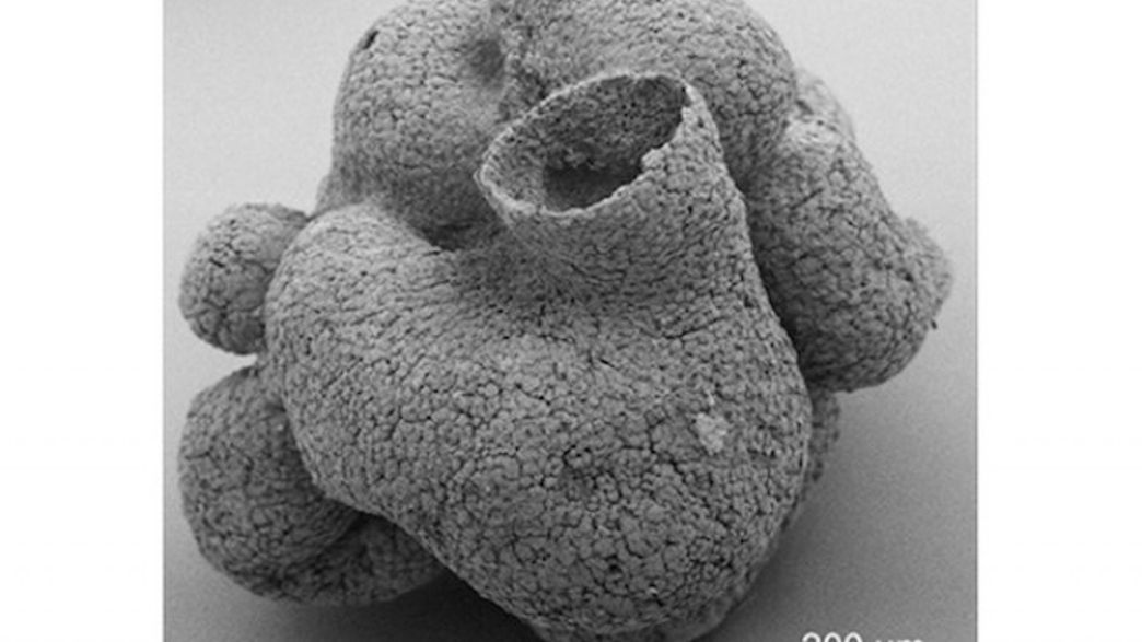 New 600-Million-Year-Old Fossil is the World's Oldest Sponge | IFLScience