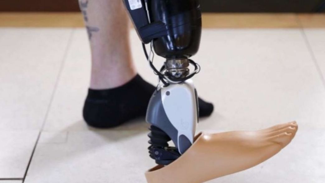 Artificial Limbs Nasa