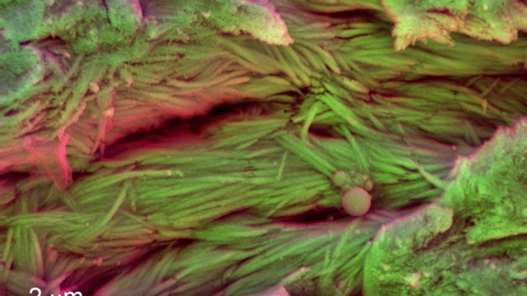 Scientists May Have Found Red Blood Cells In 75-Million-Year-Old ... Scientists May Have Found Red Blood Cells In 75-Million-Year-Old ...