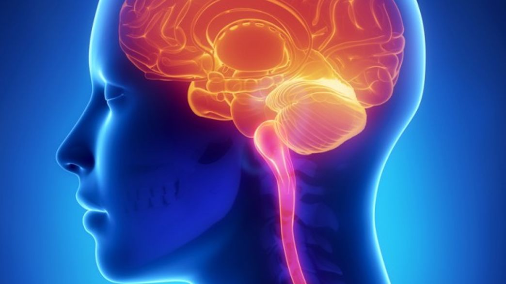 This Is What The Brain Of A Stroke Survivor Looks Like IFLScience
