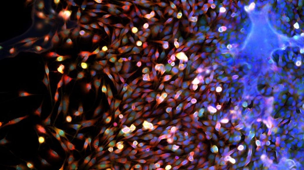 Malaria Protein Could Give Us A Broad Cancer Treatment | IFLScience