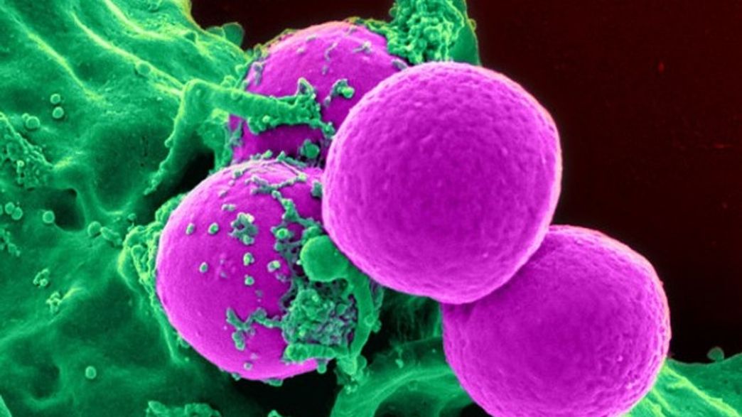 Scientists Discover Weak Spot Of The Superbug MRSA | IFLScience