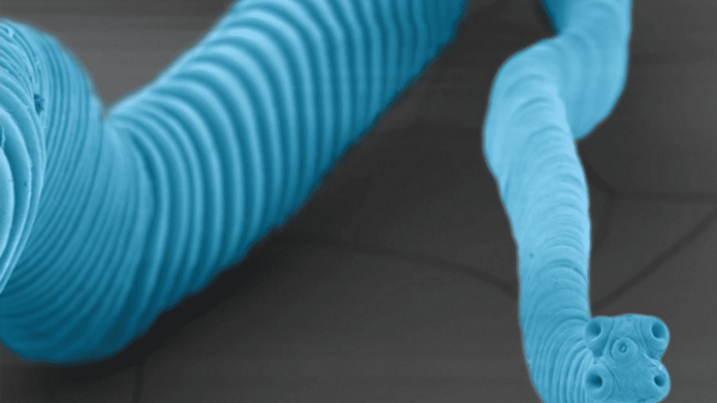 A Man Died After His Parasitic Worm Got Cancer | IFLScience