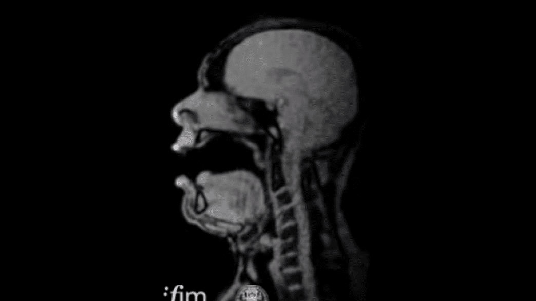 Incredible MRI Images Show What An Opera Singer Looks Like On The ...