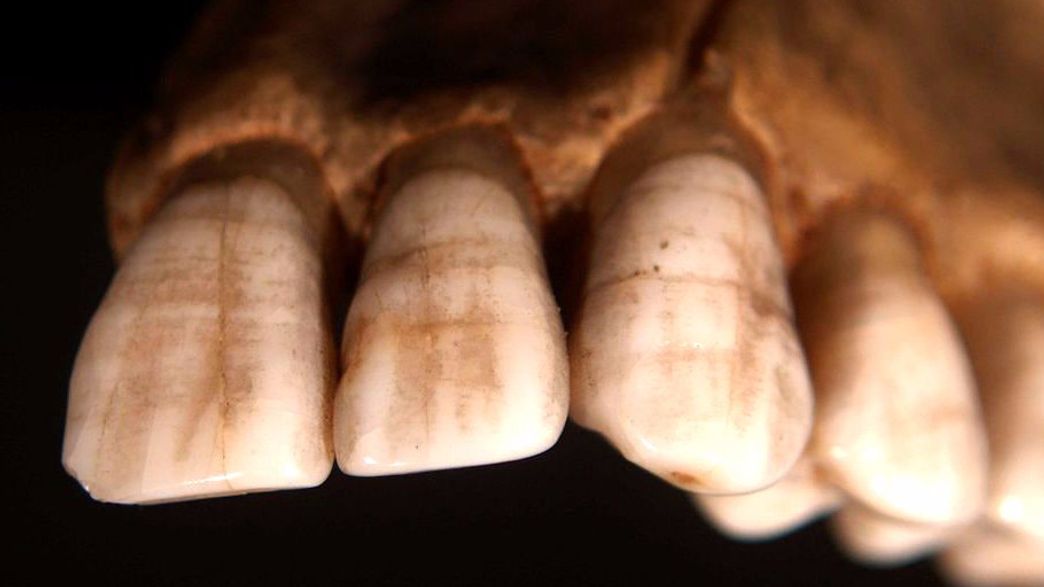 New Evidence From Prehistoric Human Teeth Reveals What The 'Paleo Diet ...