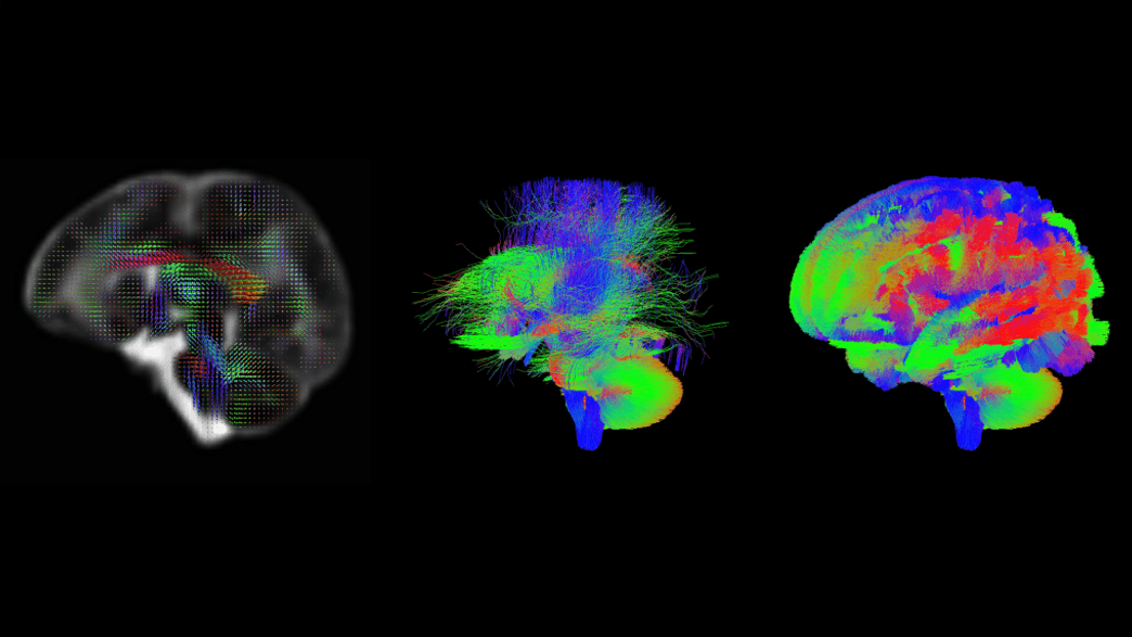 Stunning Images Of Baby Brains Will Map Out How The Brain Develops ...