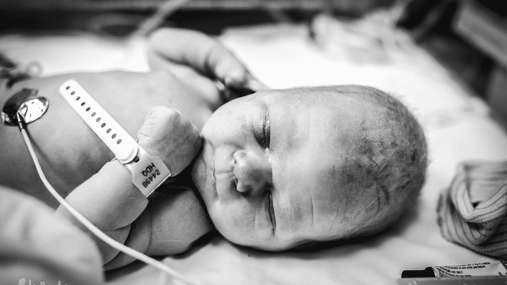 Incredible Images Reveal What Can Happen To A Baby’s Head During Birth ...