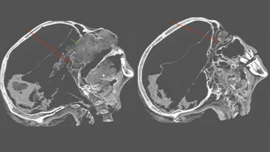 Face And Brain Of 3,800-Year-Old Egyptian Mummy Recreated | IFLScience