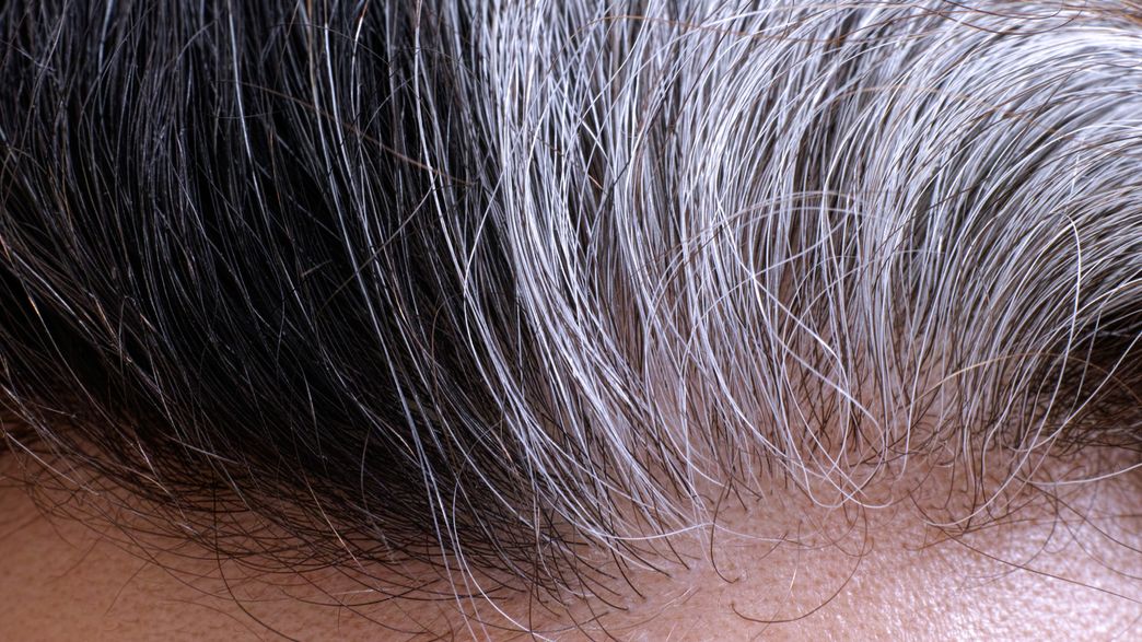 Immunotherapy Drugs Also Appear To Restore Hair Color In Patients ...