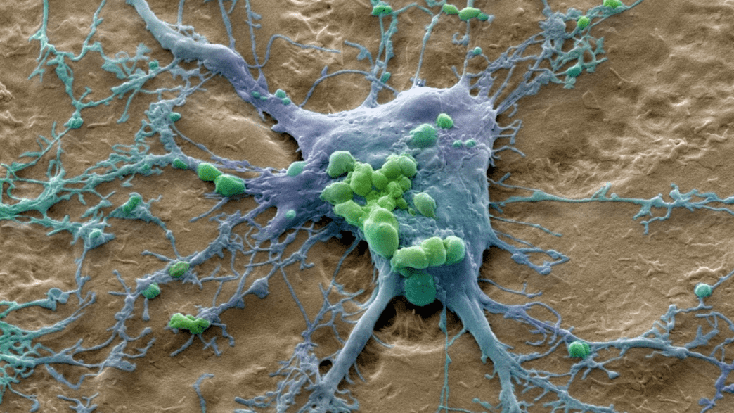 Why Haven t We Found A Cure For Cancer Yet IFLScience Why Haven t We Found A Cure For Cancer Yet IFLScience