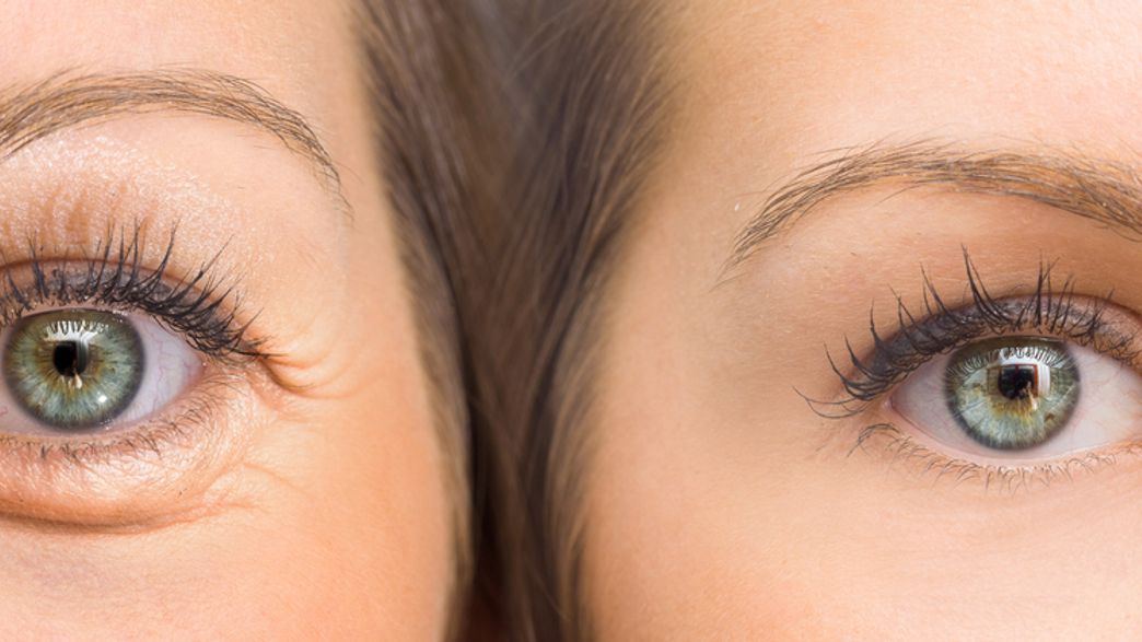 This Latest Health Fad Just Sounds Revolting | IFLScience