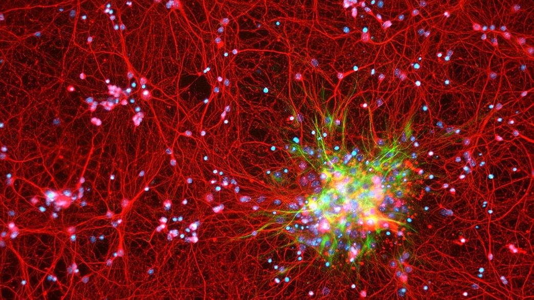 Experimental Injection Converts Brain Support Cells Into New Neurons ...