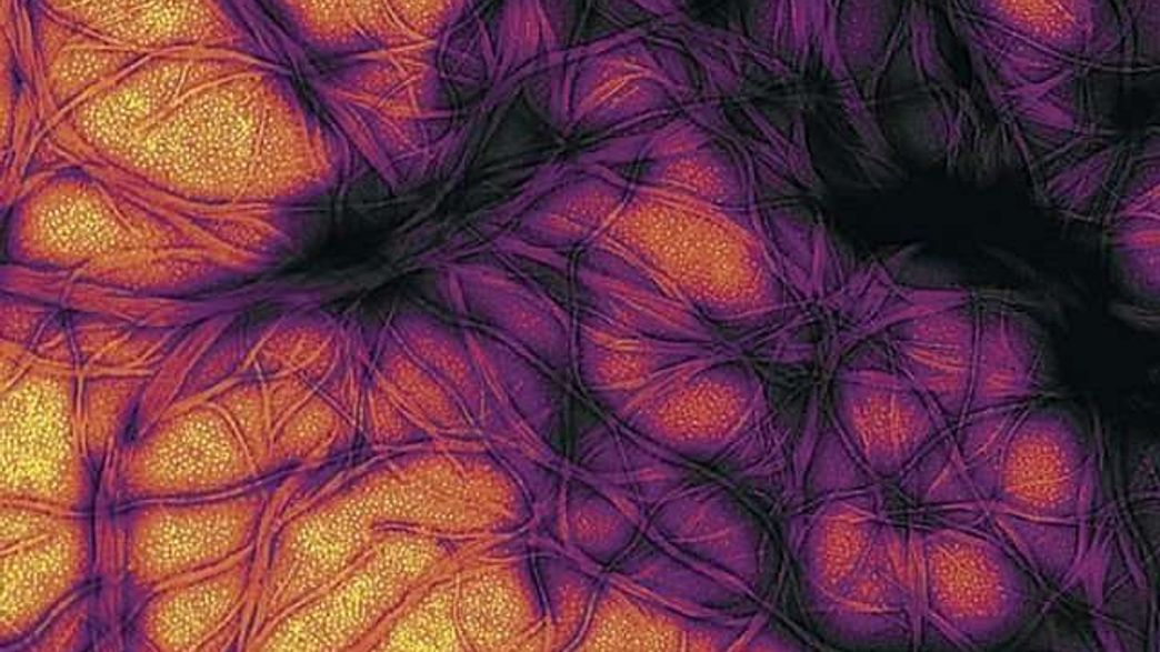 New Discovery Raises Prospect Of Diagnosing A Rare Fatal Brain Disease ...