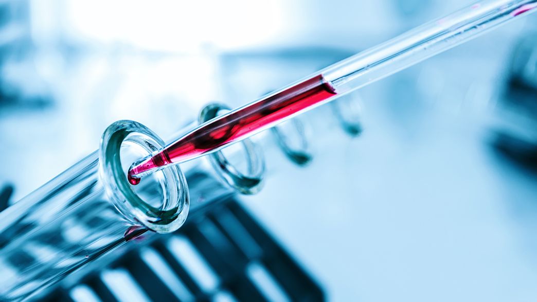 Researchers Develop First Potential Blood Test For Chronic Fatigue ...