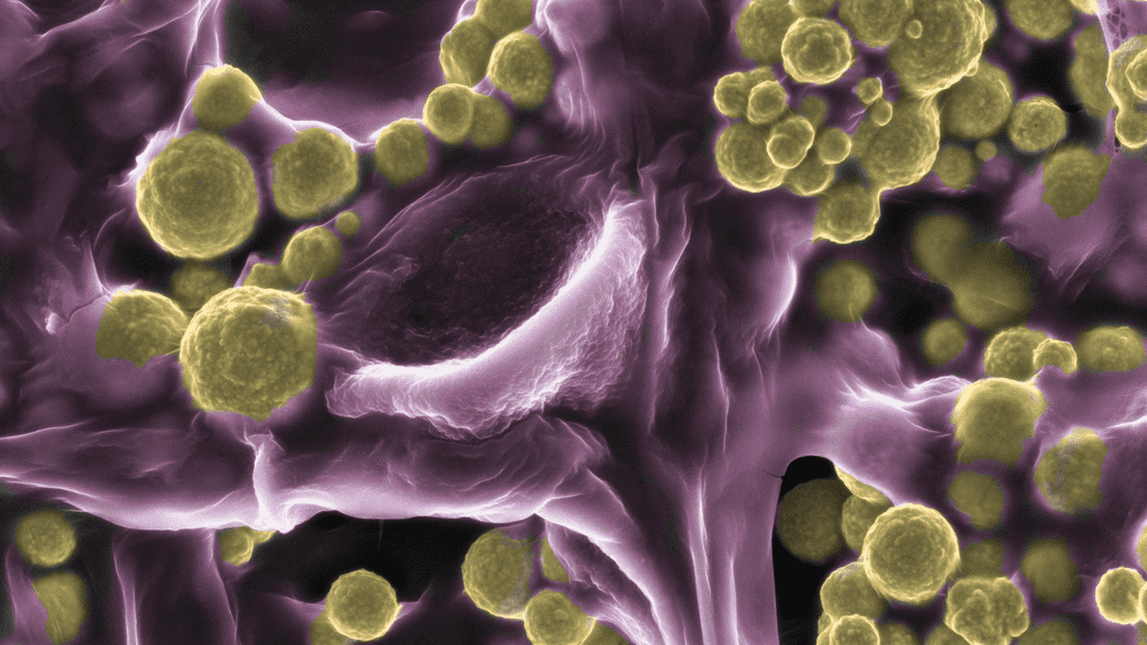 Meet The Fungus That Mines And Wears Gold – And Could Help Us Find ...