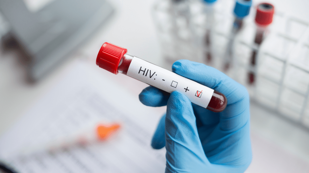 HIV Vaccine Nears Clinical Trial After Passing Key Safety Test | IFLScience