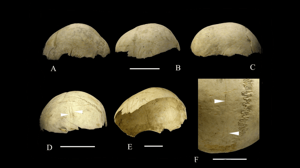 Prehistoric Human Skull Cups In Europe Were Carefully Cleaned Of Scalp ...