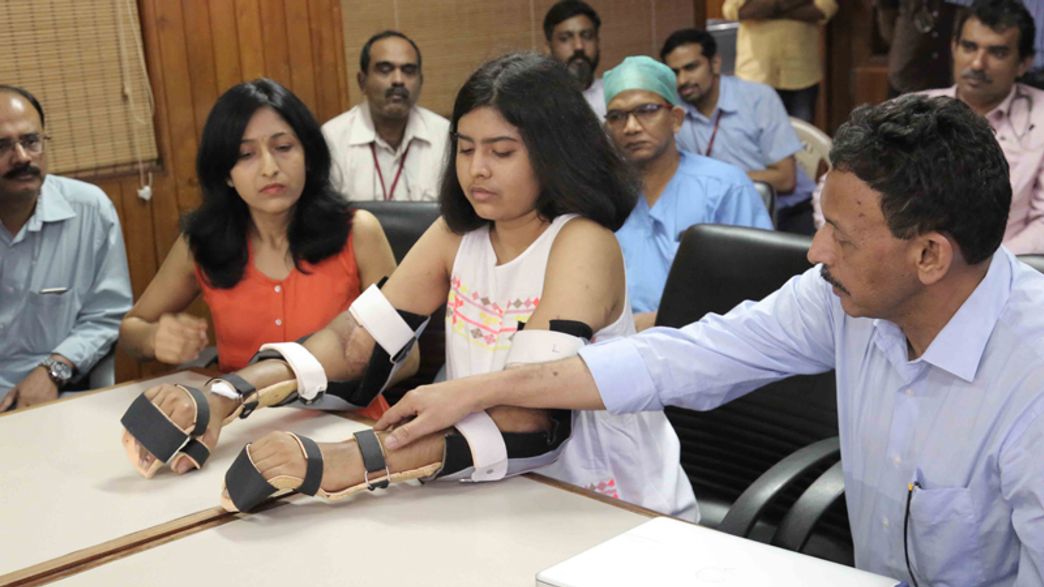 Doctors Baffled By Transplant Patient's New Hands Changing Color ...