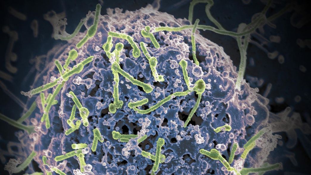 New Potential Universal Ebola Vaccine Shows Promise In Early ...