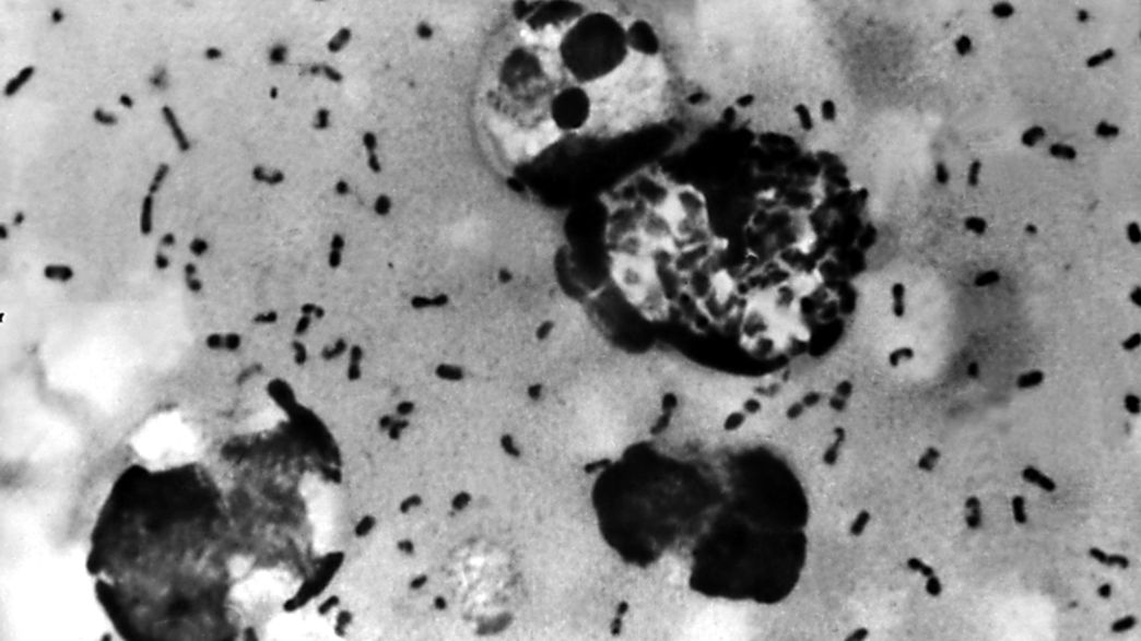 Case Of Plague Confirmed In California For First Time In Years | IFLScience