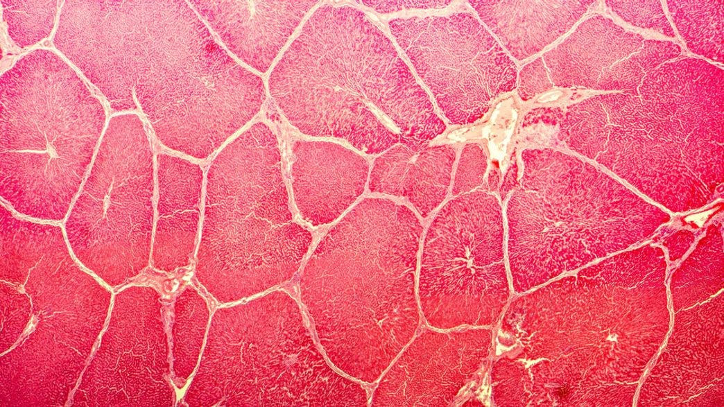 Hepatocytes Grown In Pig's Lymph Nodes Can Reverse Liver Failure, Study ...