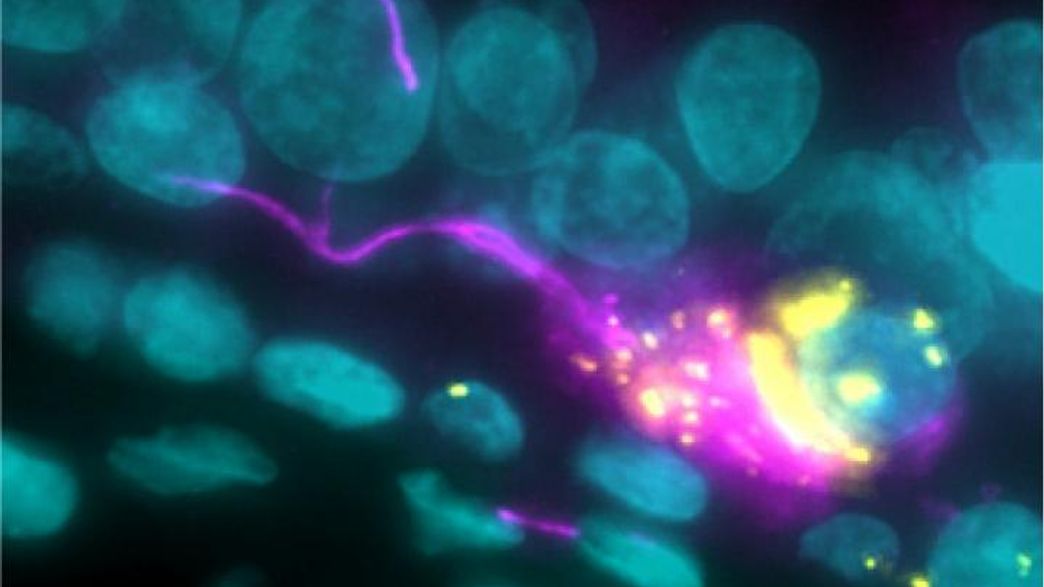 How Covid-19 Might Sneak Into The Brain Shown In New Images | IFLScience