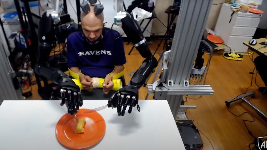 Brain Implants Give Quadriplegic Man Simultaneous Control Of Two ...