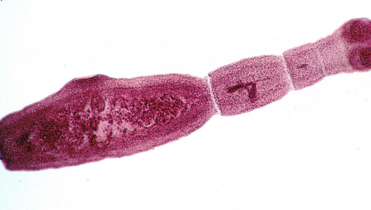 Dog Parasite Causing Cancer-Like Growths In Humans Is On The Rise In ...