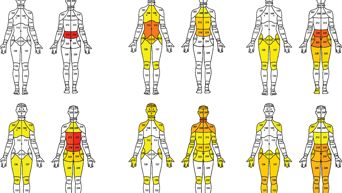 There Are Nine Distinct Types Of Chronic Pain, Says "Pain Body Map ...