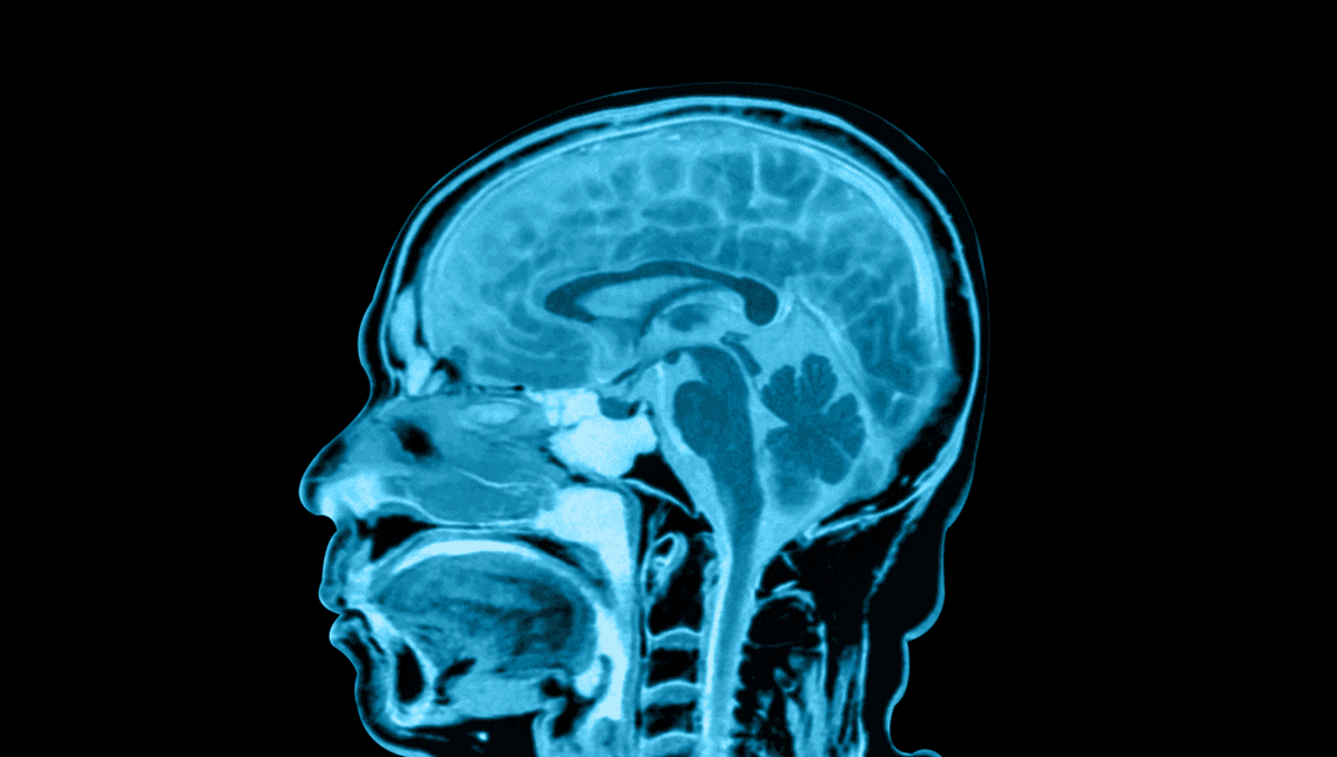 MRI Scan Shows How Weird The Human Tongue Looks While Beatboxing ...