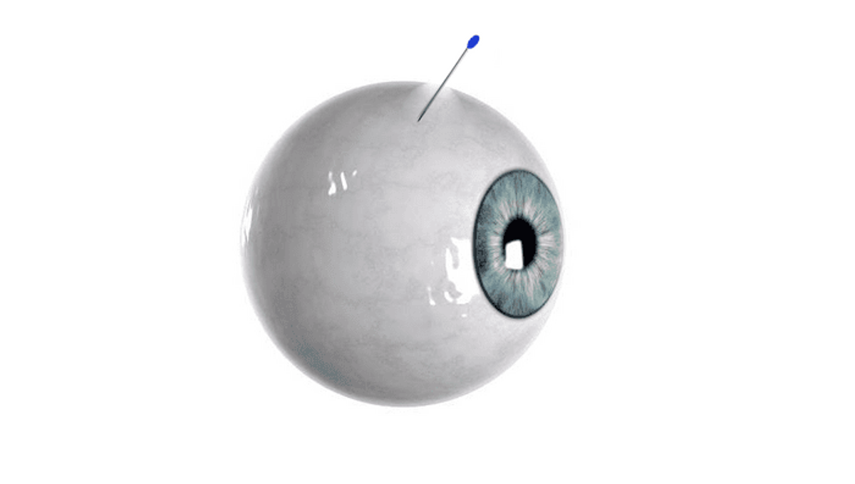 Self-Plugging Eye Needle Could Revolutionize Drug Delivery | IFLScience