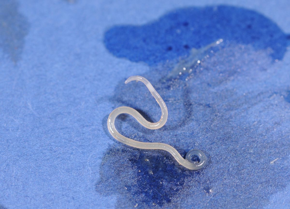 Parasitic Worms With Drug-Loaded "Suit Of Armor" Could Hunt Cancer ...