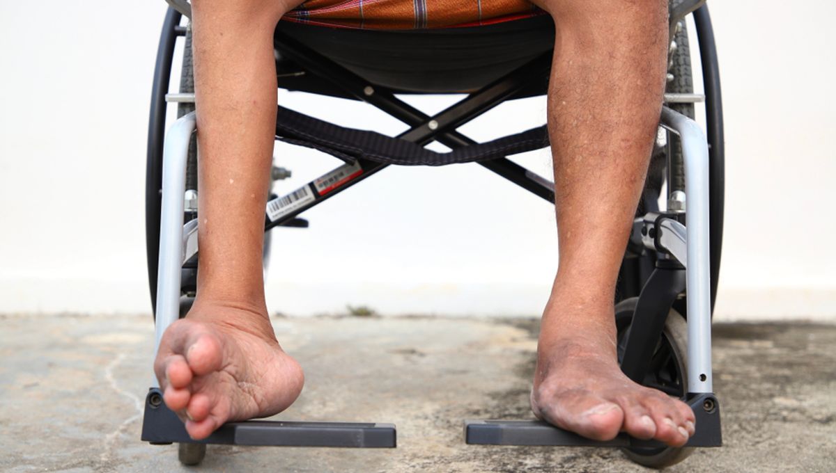 A Virus That Can Cause Polio-Like Paralysis In Kids Is On The Rise ...