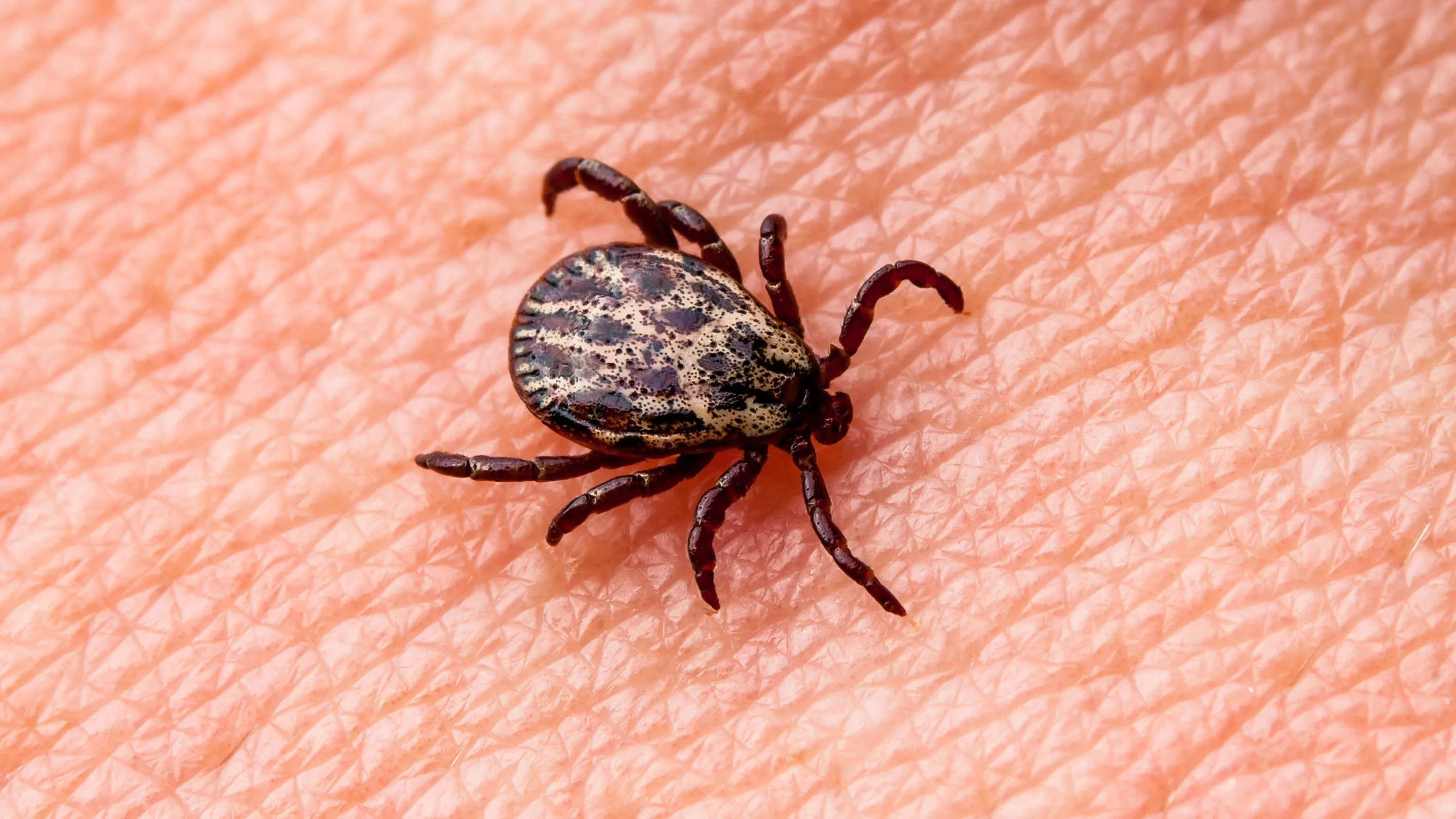 A Lyme Disease Vaccine Existed Until Antivaxxers Killed It | Faculty of ...